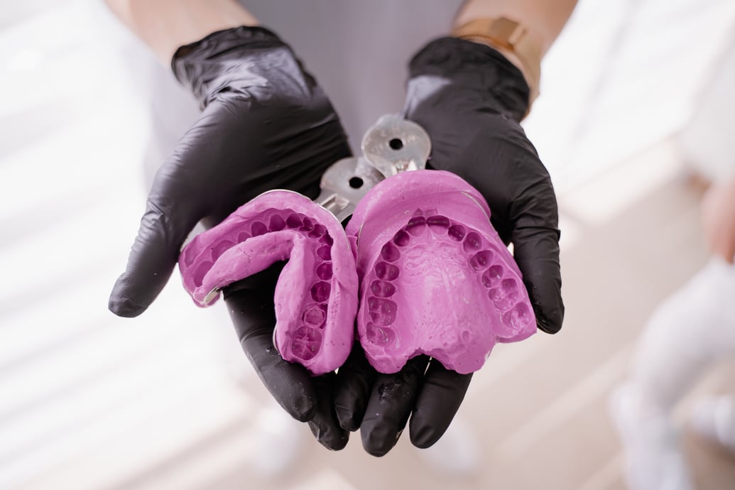 Revolutionizing Dentistry: Overcoming Traditional Impression Challenges ...