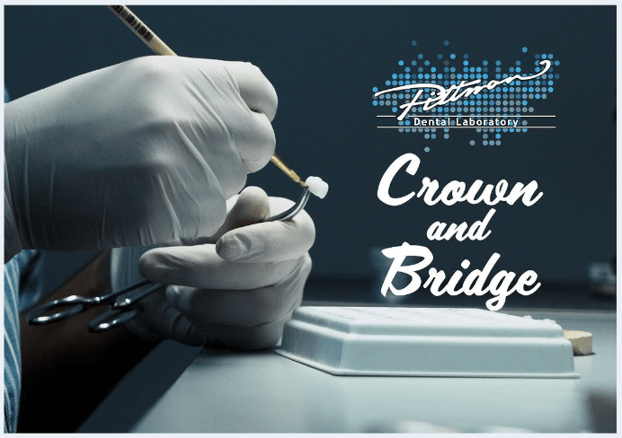 Navigating the Maze: A Comprehensive Guide to Crown and Bridge Material ...