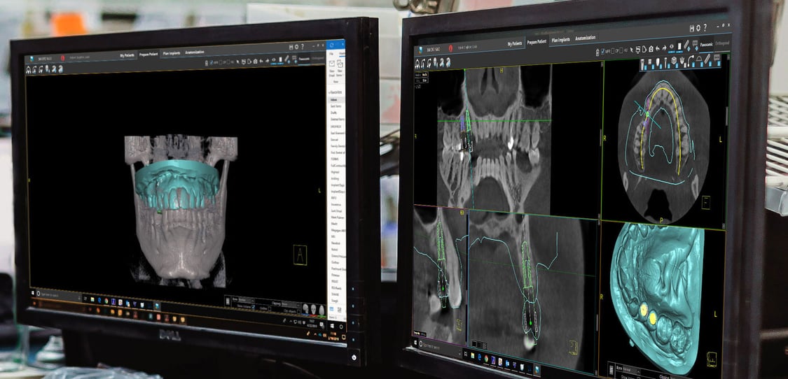 Transforming Dentistry: Tech Innovations in the Digital Laboratory