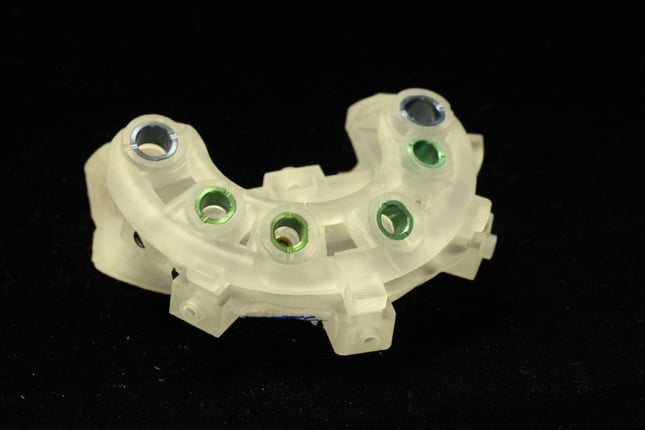 Capture®: Pittman Dental Lab's Guided Full-Arch Solution