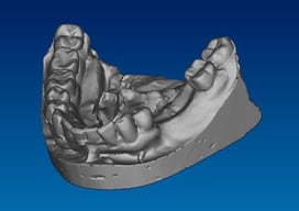 Send a STL File - Pittman Dental Laboratory