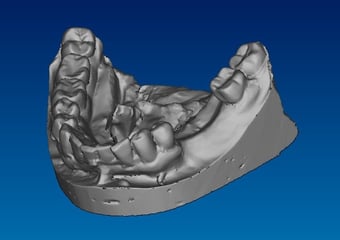 Send a STL File - Pittman Dental Laboratory