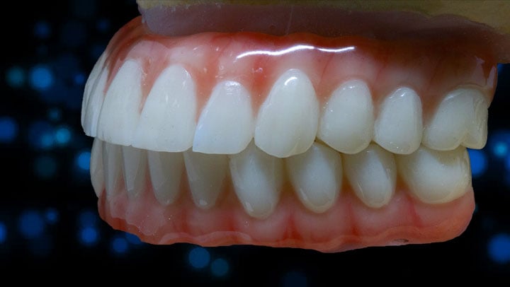 Crown and Bridge - Pittman Dental Laboratory