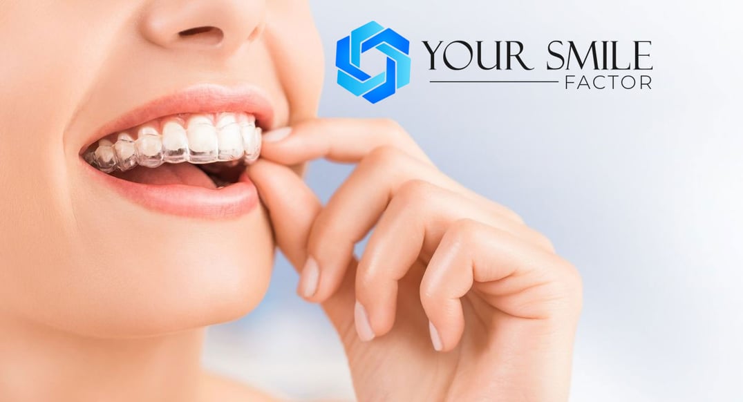 Harnessing the Profit-Boosting Potential of Clear Aligners in Your ...